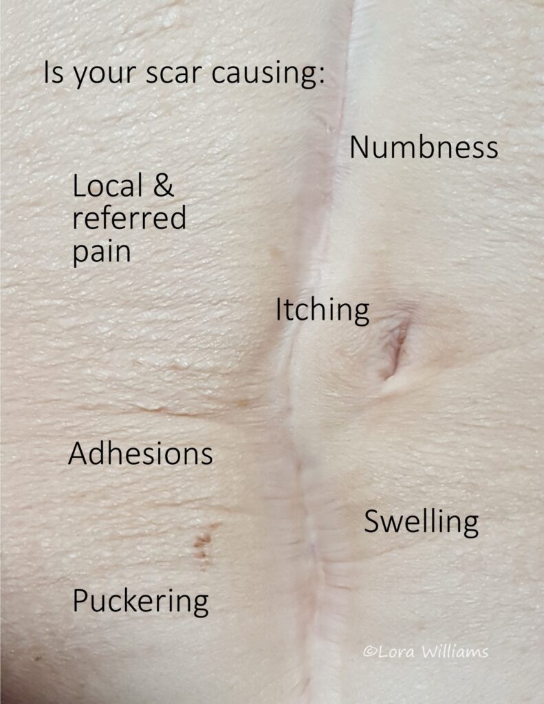 Scar Release Therapy - Connect Release Heal